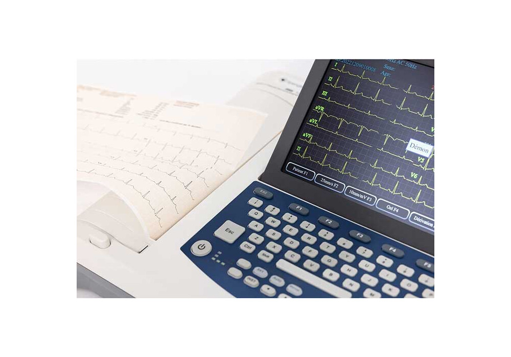 Appareil ECG 12 dérivations Cardiomate Spengler